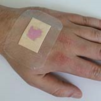 Color changing dressing to indicate infections - MoreInspiration