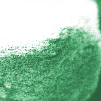 Injectable ‘Smart Sponge’ - MoreInspiration